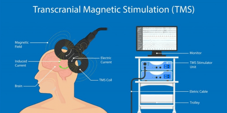 A Comprehensive Guide to TMS and ECT Therapy - Avisa Recovery